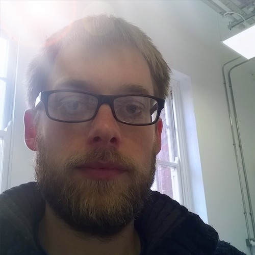 About Us – Virtual Reality Prosthetics